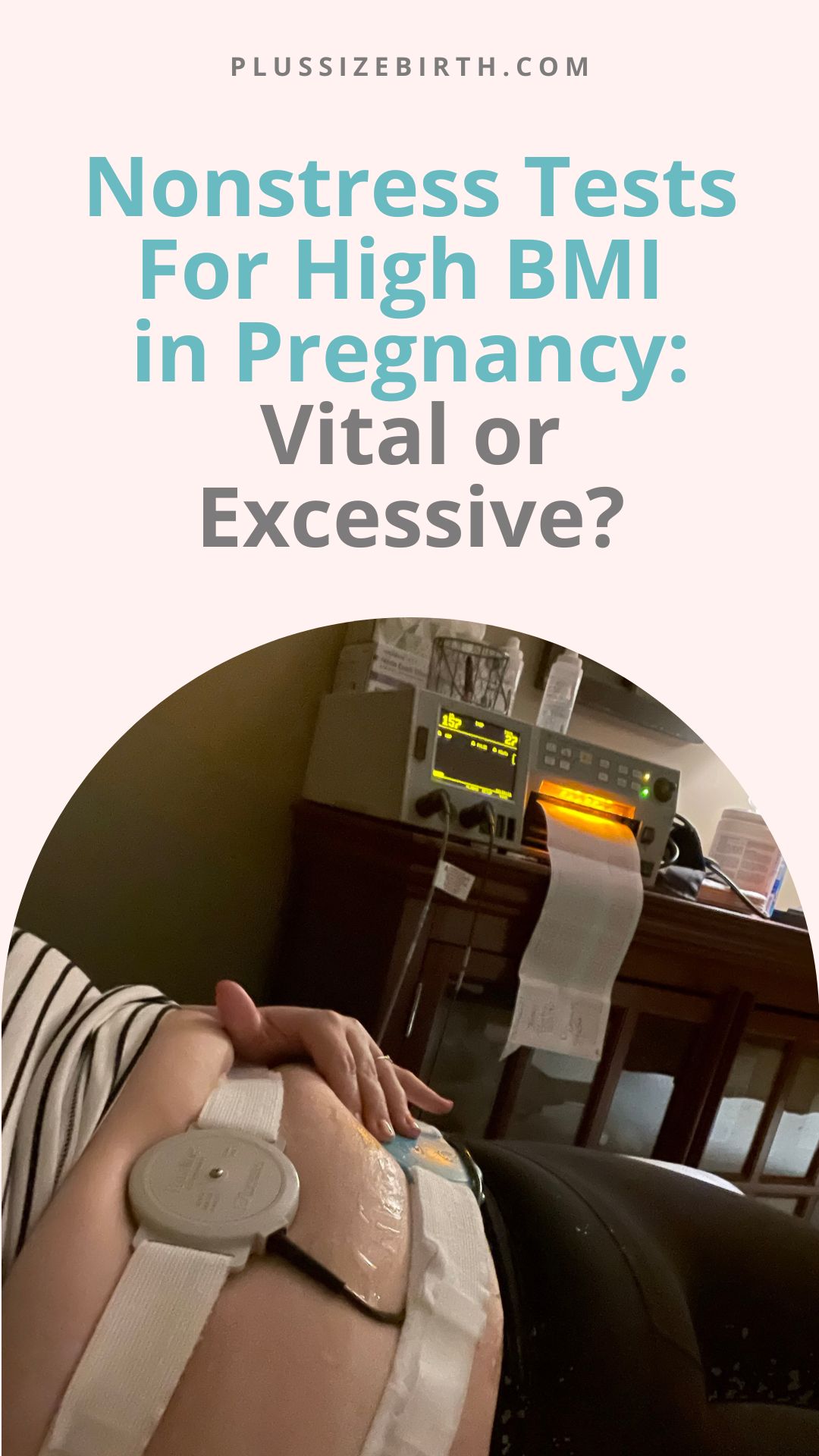 Nonstress Tests For High BMI In Pregnancy Vital Or Excessive Nonstress Tests For High BMI In Pregnancy Vital Or Excessive